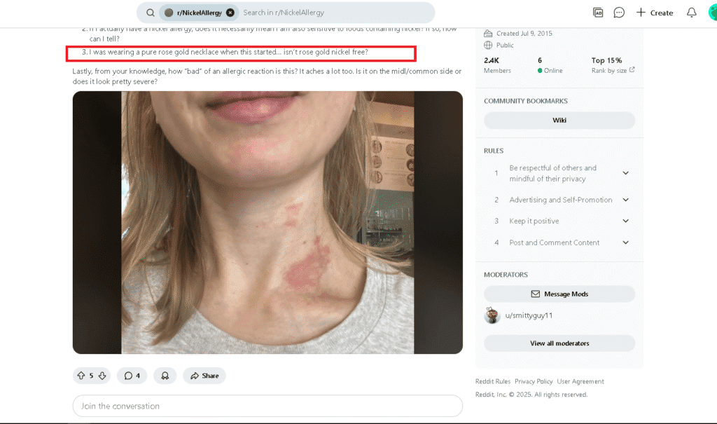 Is Rose Gold Hypoallergenic? And Which Forms of Rose Gold are Most ...